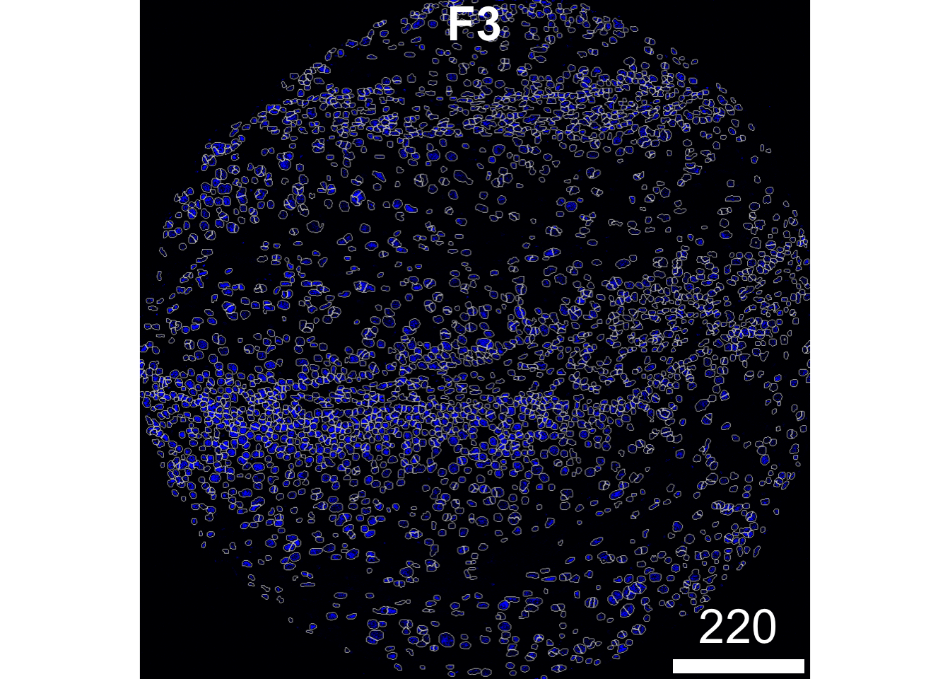 12 Case Study: Head and Neck Squamous Cell Carcinoma (Ferguson et al ...